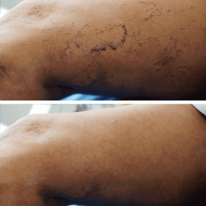Ivy League-Trained Pain & Vein Doctors | Visit Our Clinics